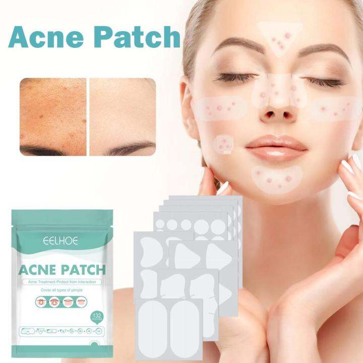 HOLD LIVE Acne Pimple Patch 132pcs Acne Pimple Master Patch Invisible ...