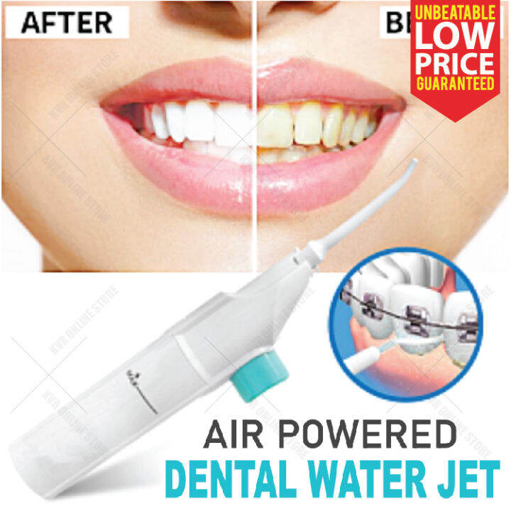 Portable Power Floss Dental Water Jet Teeth Dental Hygiene Oral Pick ...