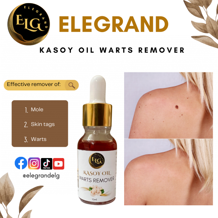 Elegrand Pure and Organic Kasoy Oil Warts Remover Herbal Nunal Remover ...