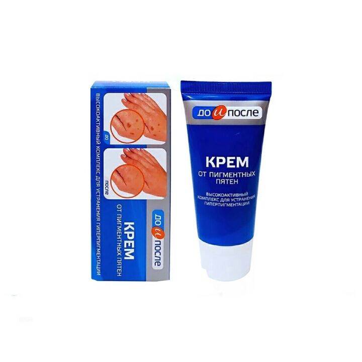 Kem Đồi Mồi KPEM Nga Bôi Đồi Mồi, Nám, Sạm, Đốm Nâu Da Tay, Lão Hoá Da ...