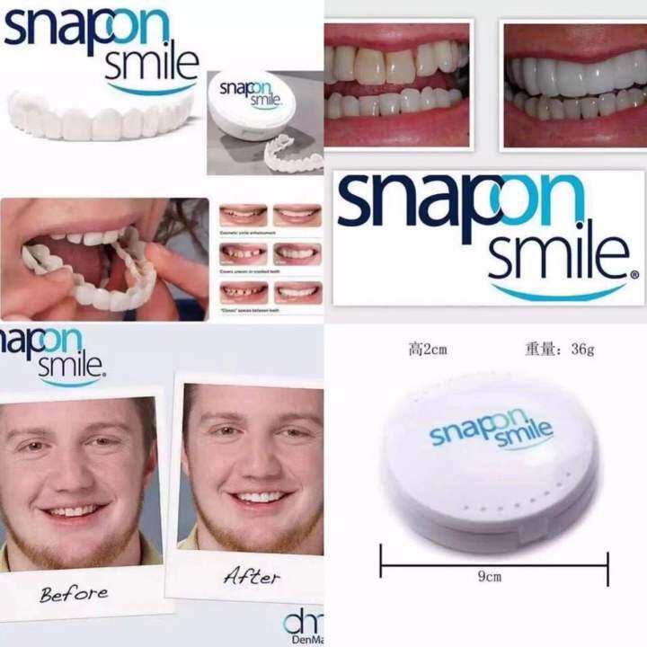 Snap On Smile Teeth One Size Fits Snapon Snap-on Smile | Lazada PH