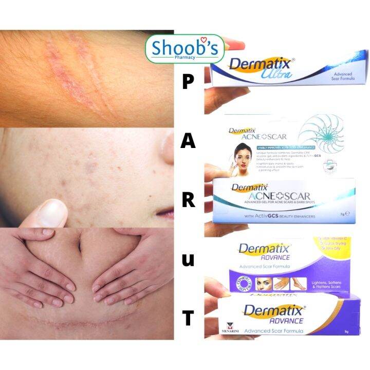 DERMATIX/Ubat Parut/Krim Parut Jerawat/Dermatix Ultra Gel 15G/Dermatix ...