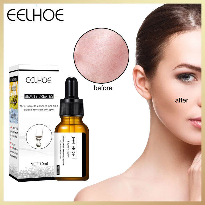 Eelhoe Nicotinamide Essence Solution Hyaluronic Acid Face Serum ...