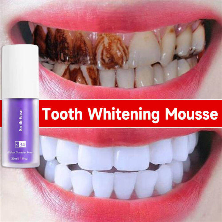 Smile Ease Toothpaste V34 teeth whitening color corrector teeth colour ...