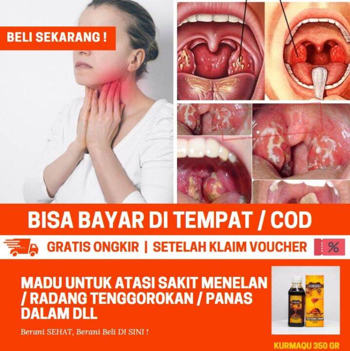 OBAT SUARA SERAK DAN TENGGOROKAN SAKIT, OBAT PITA SUARA BENGKAK, OBAT ...