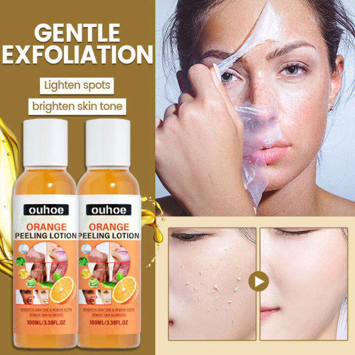 100ML Yellow Peeling Oil Orange Peeling Lotion For Face/Body Whitening ...