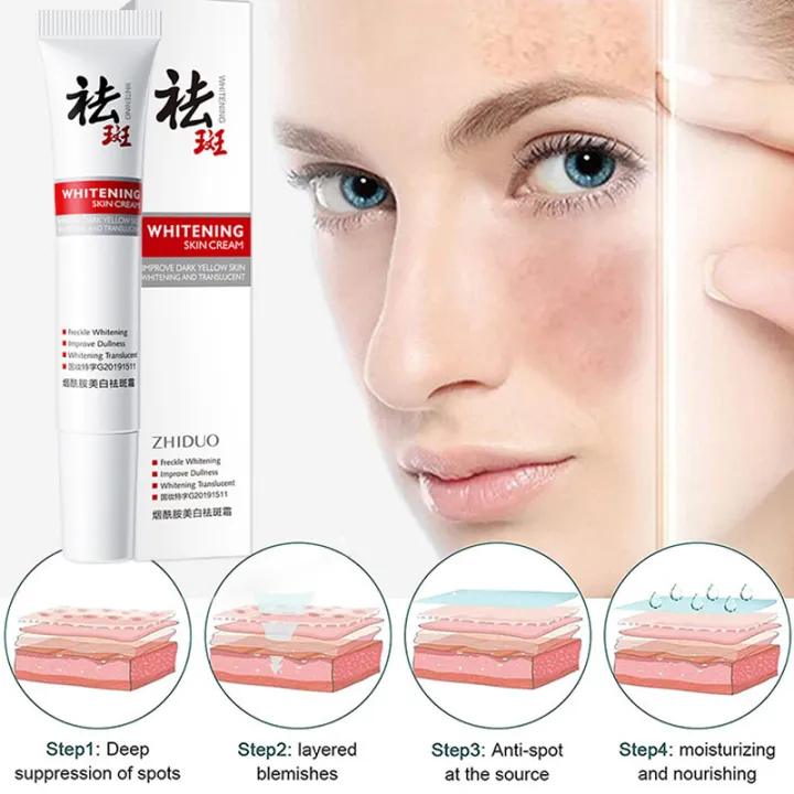 Lady Skin Cream Magic Glow Freckle Removal Whitening Cream Freckles ...