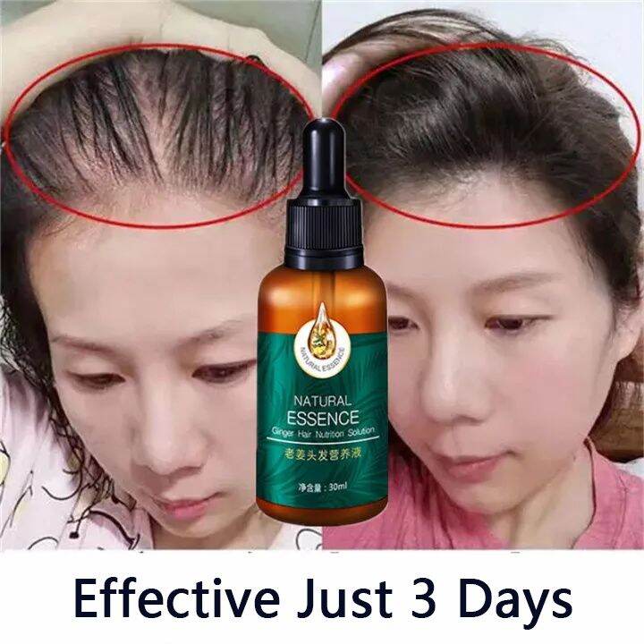 Hair Grower Serum Hair Grower Castor Oil Hair Growth Spray Essence
