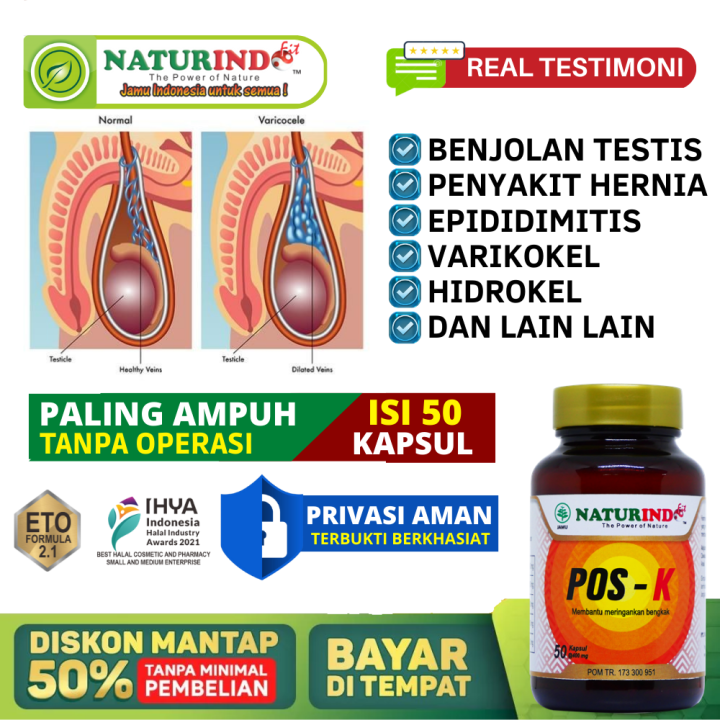 Obat Varikokel Paling Ampuh Testis Bengkak Parikokel Tanpa Operasi Buah ...