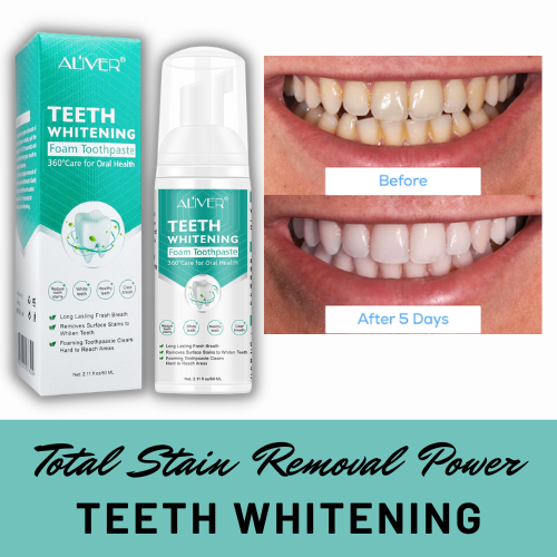 New Improved Formula Aliver Teeth Whitening Mousse Toothpaste Teeth ...