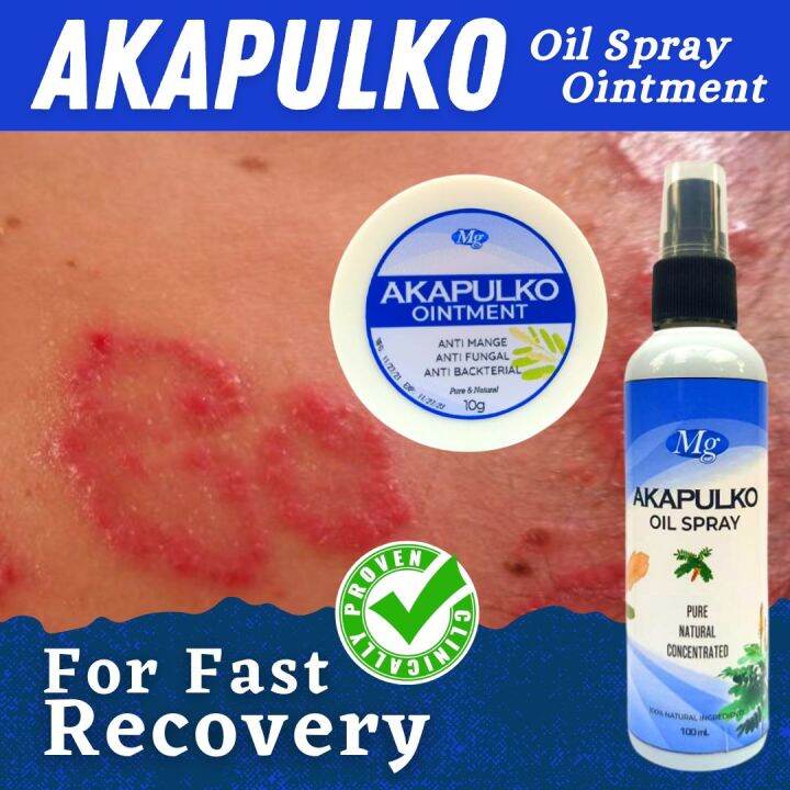 MG AKAPULKO OIL SPRAY 100ML & OINTMENT 10G Allergy Relief Balm: Anti ...