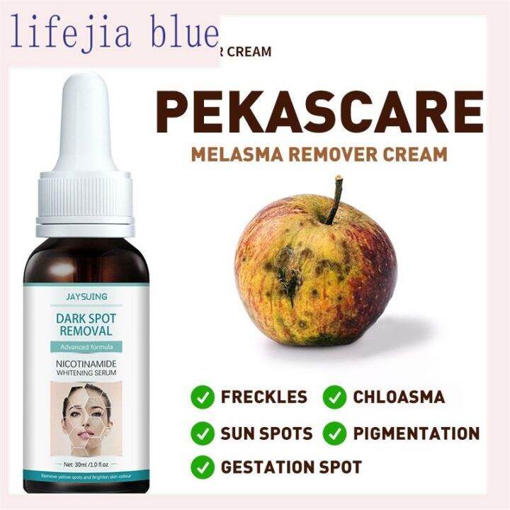 PEKAS REMOVER CREAM / MELASMA CREAM Melasma Pekas Care Dark Spots ...
