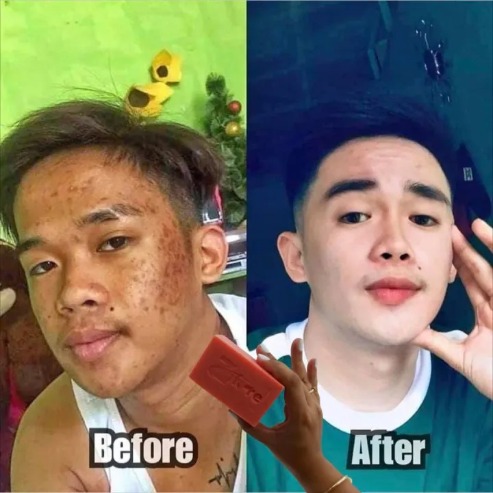 [ORIGINAL] Cocoberry 10x Flawless Skin Fragrant Soap with Glutathione ...