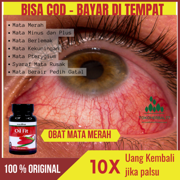 Obat Mata Merah Minus Plus Berlemak Kekuningan Tetes Mata Buram Selaput ...