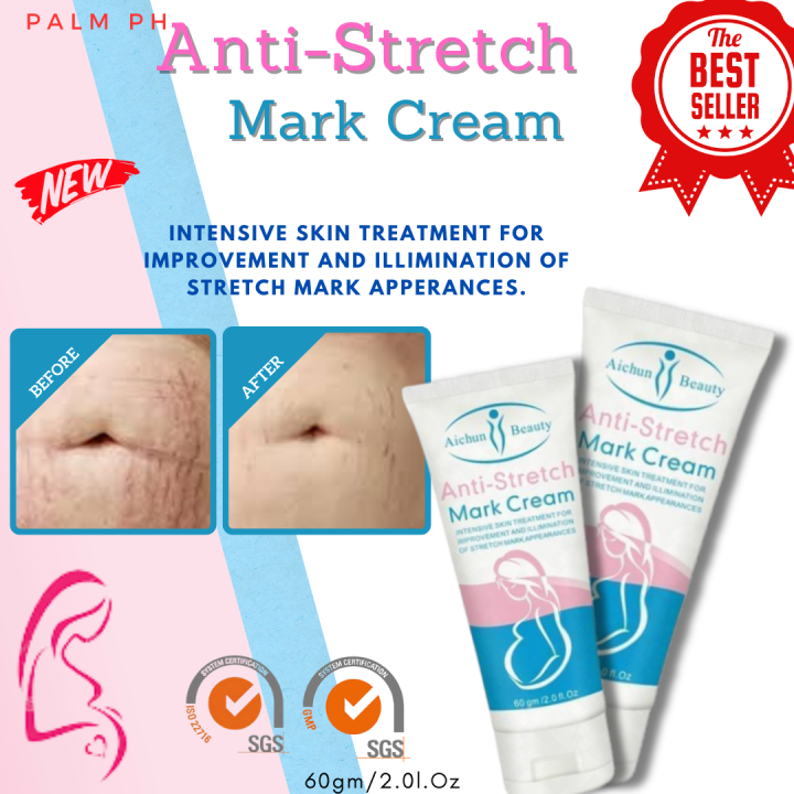 Anti-Stretch mark cream(60g) Intensive Skin Treatment | Lazada PH