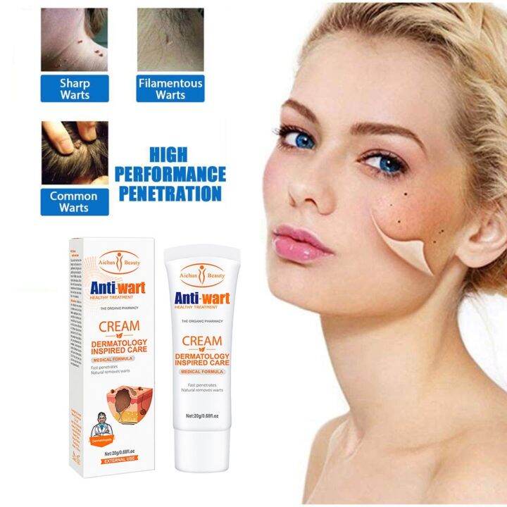 Body wart removal cream to remove corns and warts liquid to remove ...