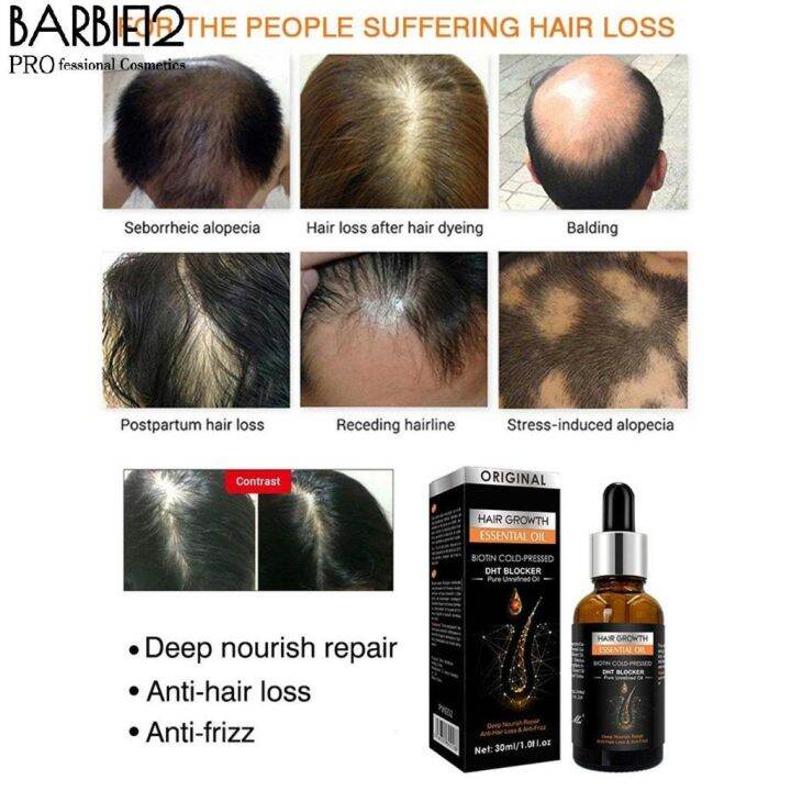 New Promo Hair Growth Essential Oil Biotin Cold Pressed Dht Blocker And
