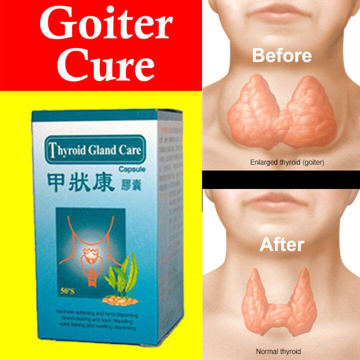 Thyroid Gland Care 400mg 50 capsules, Goiter supplement, Goiter, Goiter ...