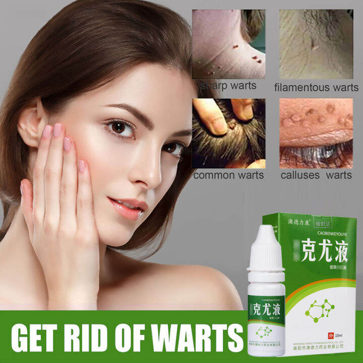 Gram Wart Liquid Fast Removal Of Flat Warts Painless Wart Remover ...