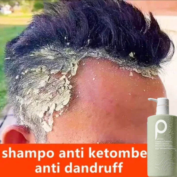 Anti-dandruff shampoo Sampo anti ketombe Shampo anti rontok Pengontrol minyak anti-gatal anti ...