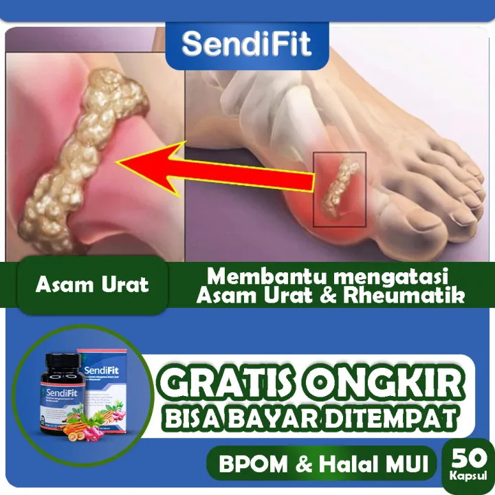 Obat Asam Urat, Gout, Patah tulang, Pseudogout, Traumatic synovitis ...