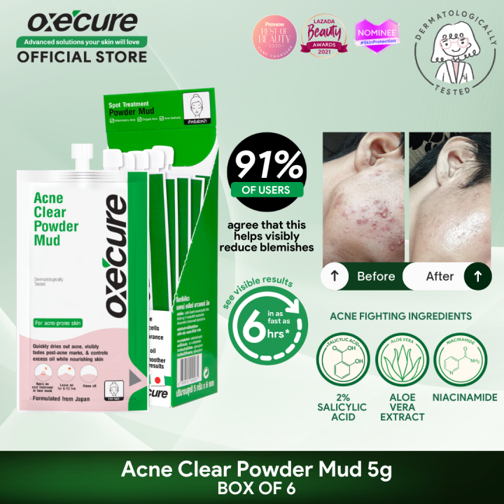 [BUY 3 GET 3 ON NOV 24-27] OXECURE ACNE CLEAR POWDER MUD 5g [Pimples ...