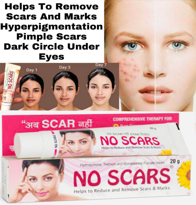 Scar Star No Scars Reduce and Remove Scars And Marks | Lazada PH