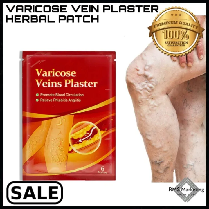 NEW VARICOSE VEINS PLASTER Varicose Veins Pain Relief Plaster Herbal ...