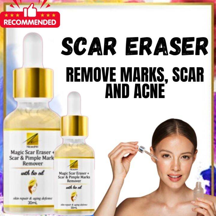 Scar Eraser by Nice Ahh Acne All Types of Skin Treatment Whitening ...