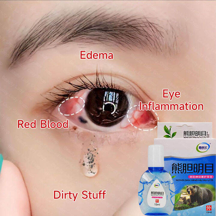 Eye Drop Relieves Red Eyes Discomfort Blurred Vision Dry Itchy Eyes Clean Detox Care for clear ...