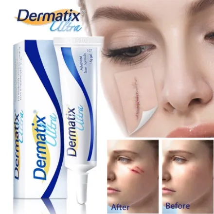 Dermatix Ultra Gel 15gr Dermatic Cream Penghilang Bekas Luka Bakar Lama ...