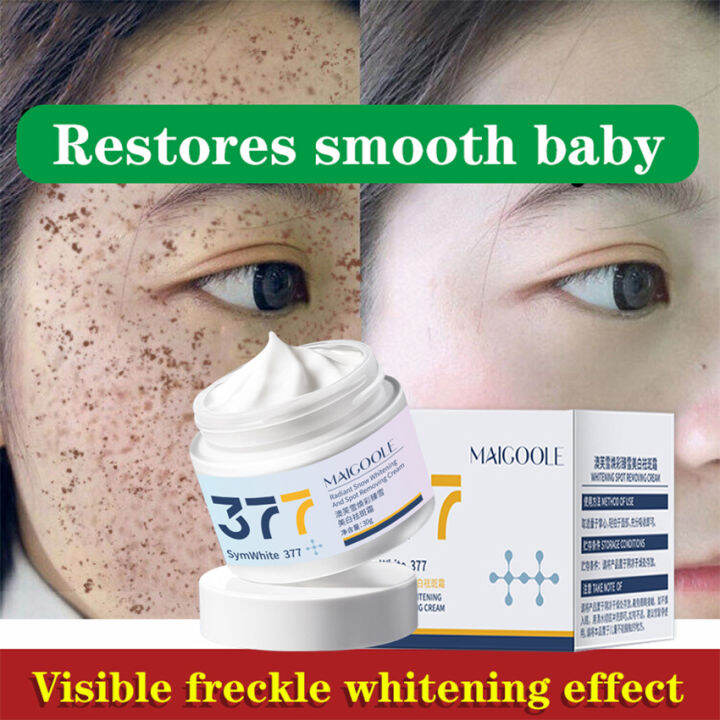 30g Melasma Cream Pekas Remover Effective Whitening Freckle Cream ...
