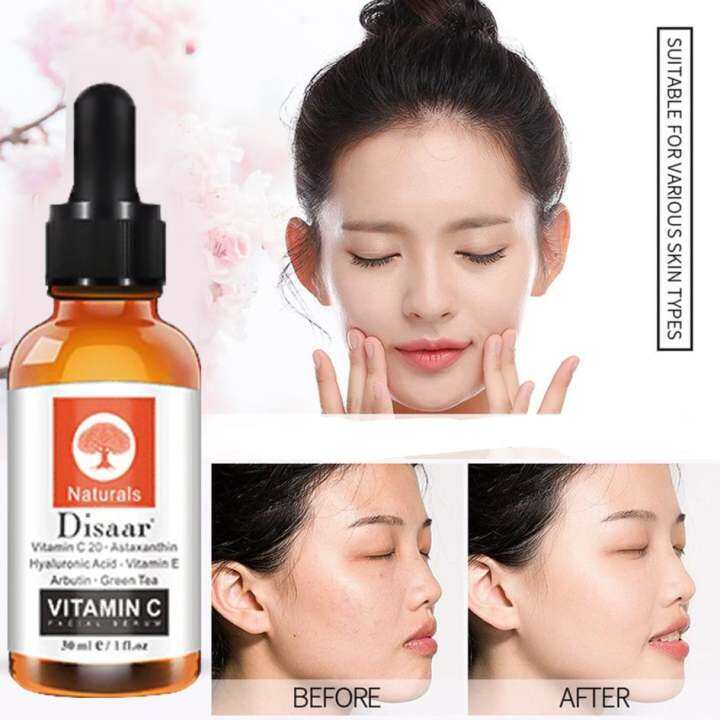 Vitamin C Serum | Lazada PH