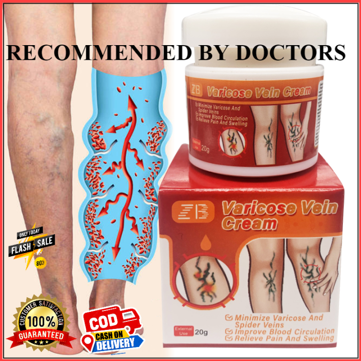 Authentic ZB 20ml Varicose Vein Cream Spider Veins Cream Swelling Pain ...