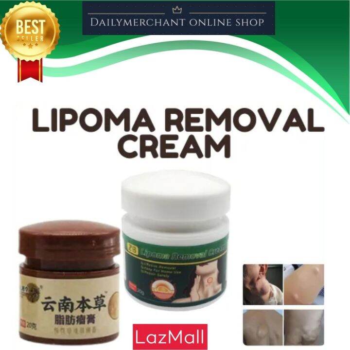 Lipoma | Removal | Herbal Ointment | Tumor Treatment | Multiple Anti ...