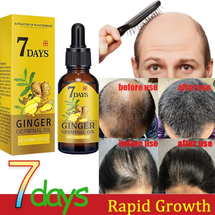 7 Days Ginger Germinal Oil Ginger Hair Growth Essence Hair Loss Liquid