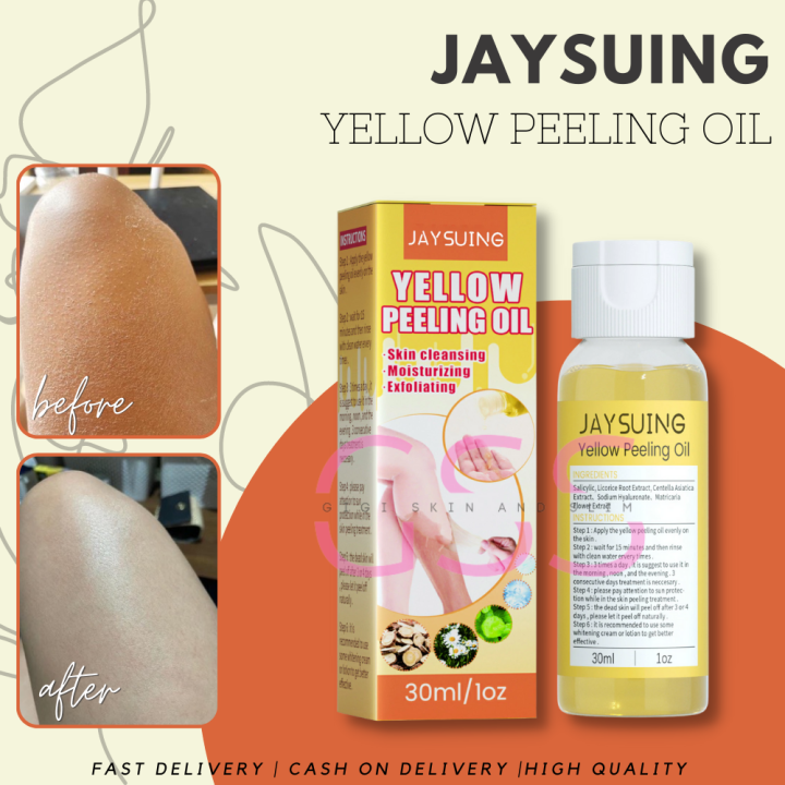 JAYSUING Yellow Peeling Oil Moisturizing Yellow Peeling Oil For Whole ...