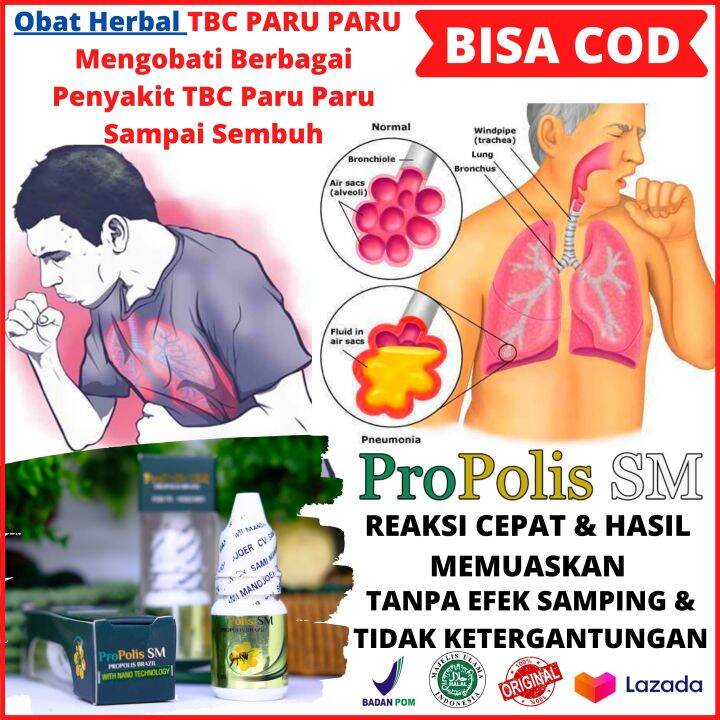 Obat TBC, Bronkitis, Batuk Berdarah, Paru Paru Basah, Flak Paru Paru, Flek, Sesak Nafas, Asma ...