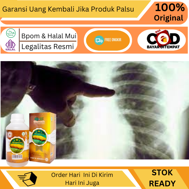 Obat Flek Paru Paru Obat Gurah Lendir Paru Paru Obat Radang Paru Paru ...
