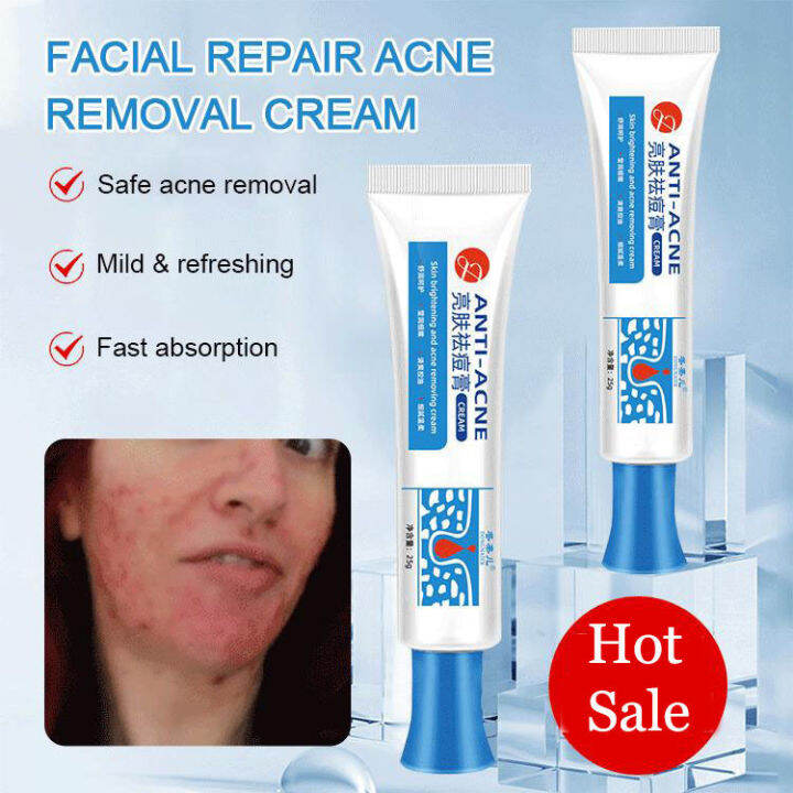 juscomart Repairing Facial Skincare Acne Fading Acne Marks Gentle Acne ...
