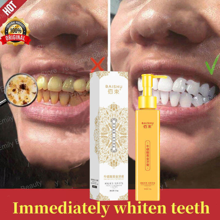 toothpaste Dental yellowing paste Beef toothpaste Whitening and fresh ...
