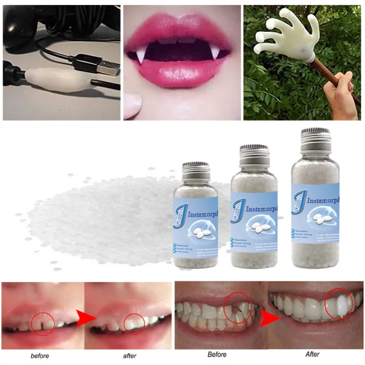 BenedictQ Temporary Tooth Repair Moldable Tooth Solid Gel Adhesive Fake ...