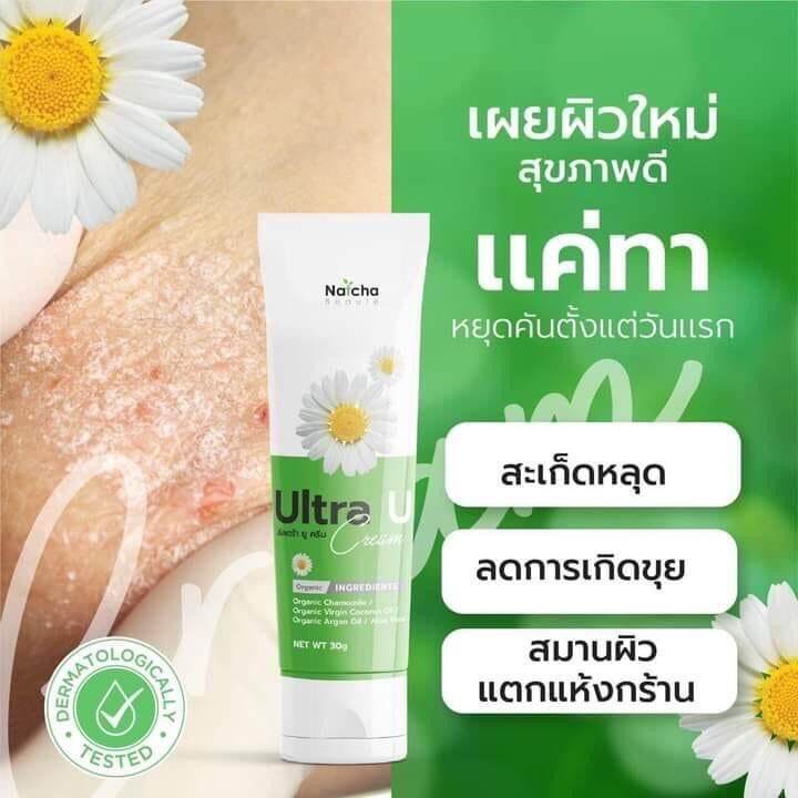 Utra u cream อัลตร้า ยู ครีมแตกลาย แพ้ยุง เชื้อรา กลากเกลื้อน ผื่น คัน ...