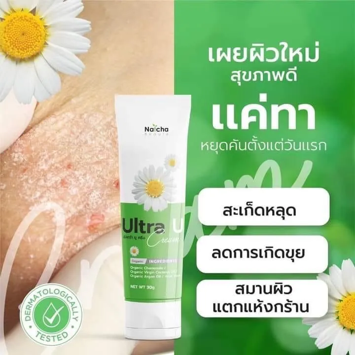Utra u cream อัลตร้า ยู ครีมแตกลาย แพ้ยุง เชื้อรา กลากเกลื้อน ผื่น คัน ...