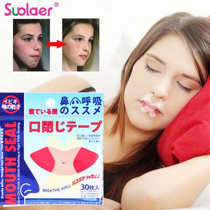Suolaer 30PCS/Bag Sleep Strips Advanced Gentle Mouth Tape for Better Nose Breathing Improved ...