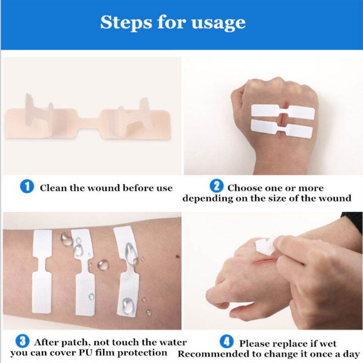 Band Aid Adhesive Bandage Waterproof Butterfly for Emergency | Lazada PH