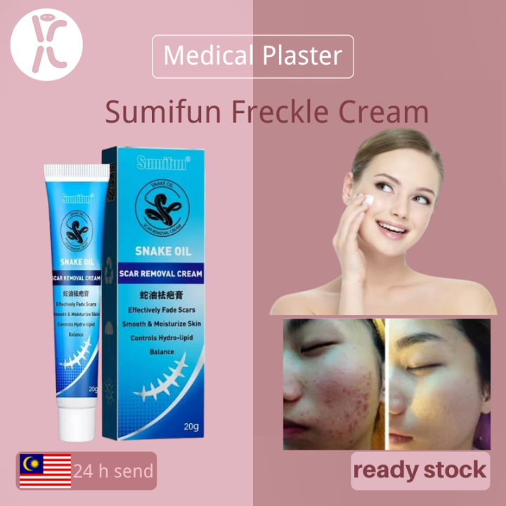 suimfun Professional snake oil ointment, freckle cream, acne treatment ...
