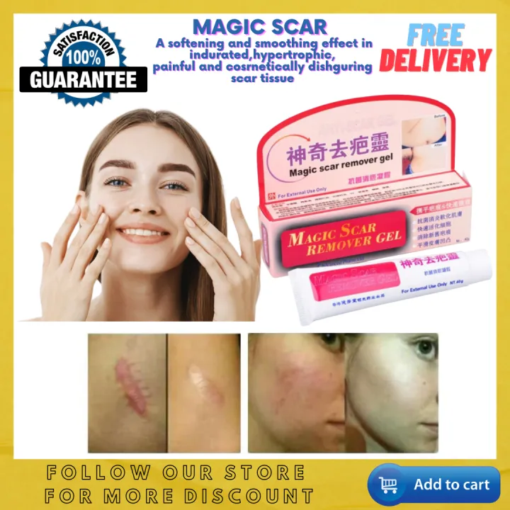 💯🔥ORIGINAL MAGIC SCAR FLASHSALE 📢 Magic Scar Remover Gel Effective for ...