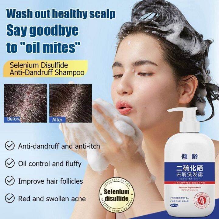 ouding Selenium Disulfide Anti-Dandruff Shampoo | Lazada PH