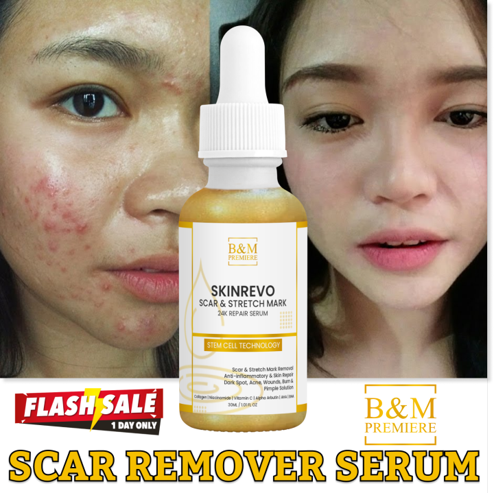 B&M PREMIERE SKINREVO SCAR & STRETCH MARK SERUM | Lazada PH B&M PREMIERE SKINREVO SCAR & STRETCH MARK SERUM | Lazada PH